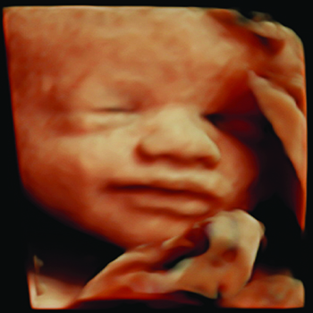 Photo Gallery - 4D Love At First Sight - 4D/HD Elective Ultrasound in ...
